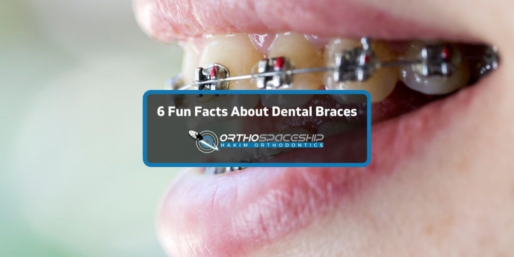 Invisible Braces Nasa